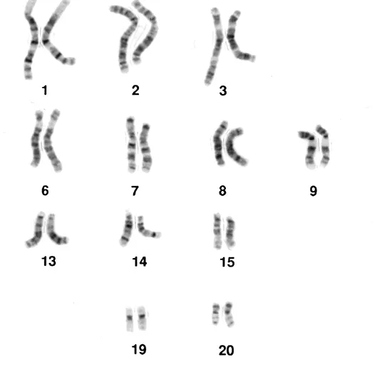 Chromosome Analysis (Genetic Disorders) Test in Delhi NCR, India | GDIC