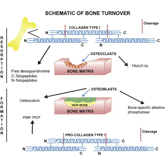 Collagen Type I C-Telopeptide (CTX) Test in Delhi NCR, India | GDIC