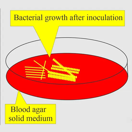 Cultured Aerobic Bacteria Identification and Sensitivity Test | GDIC