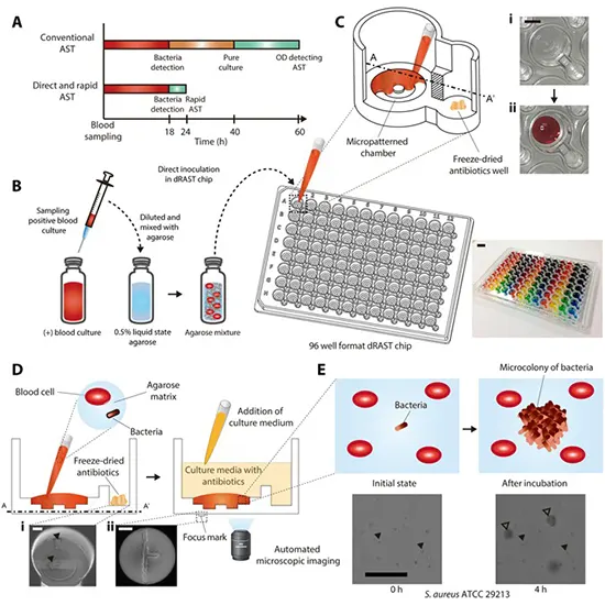 Cultured Bacteria Identification & Sensitivity Test in Delhi | GDIC