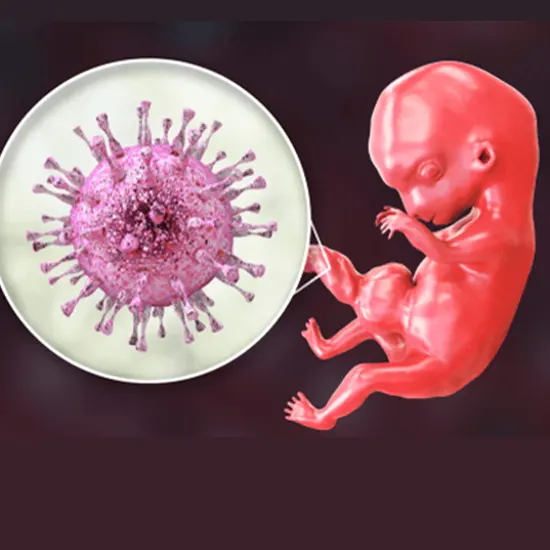 Cytomegalovirus CMV Antibodies Panel IgG IgM Test Near You in Delhi ...