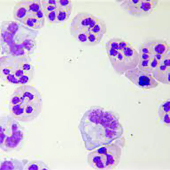 Cytology Examination Body Fluids | Test Price In Delhi, India | Ganesh ...