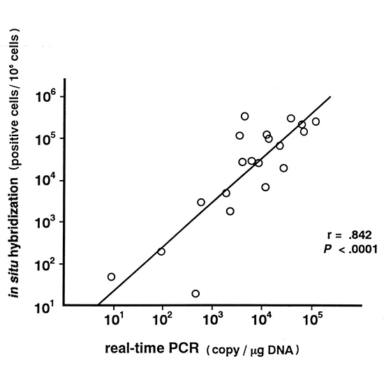 EBV Quantitative Viral Load | Test Price In Delhi | Cost Near Me, India ...