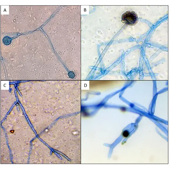 Fungus Stain And Fungus Culture Test Near You in Delhi | Book Test at ...