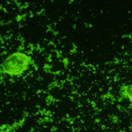 Entamoeba Histolytica Antibody Test in Delhi NCR, India | GDIC