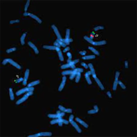 FISH for DiGeorge Syndrome Test in Delhi NCR, India | GDIC