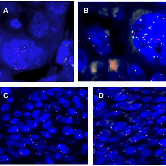 FISH for Synovial Sarcoma Test in Delhi NCR, india | GDIC