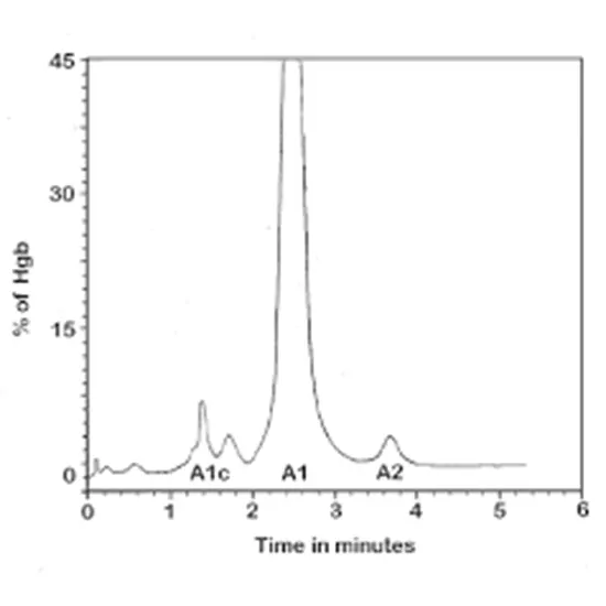 Hemoglobin HPLC | Test Price In Delhi | Cost Near Me, India | Ganesh ...