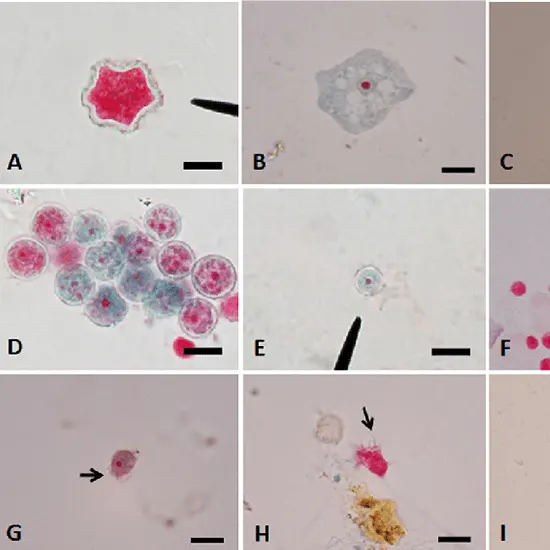 Giemsa Stain for Free Living Amoebae Test in Delhi | GDIC