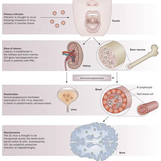 Book JC Virus DNA Detection PCR | Test Price In Delhi, India | Ganesh ...