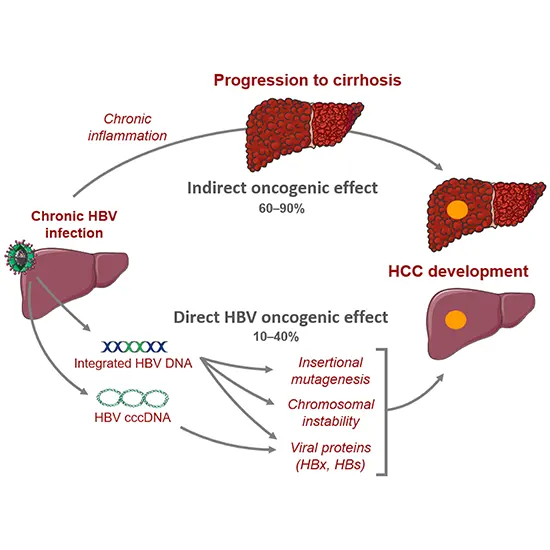 Hepatitis B Profile Comprehensive Test in Delhi NCR, India | GDIC