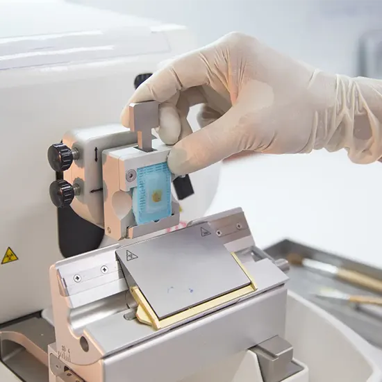 Biopsy Frozen Section | Test Price In Delhi | Cost Near Me, India ...