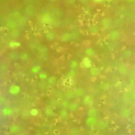 Quantitative Buffy Coat: Malaria Antigen Test in Delhi, India | GDIC