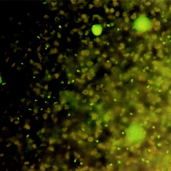 Malaria Parasite by QBC Method Test in Delhi | GDIC