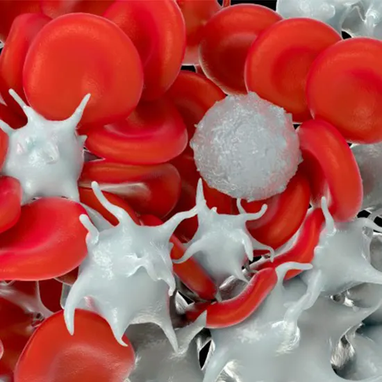 Blood Cancer Package | Test Price In Delhi, India | Ganesh Diagnostic