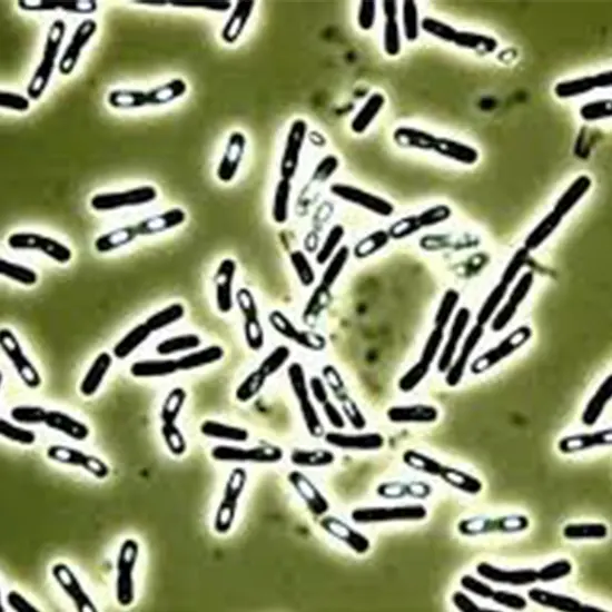 Types Of Infectious Disease Tests | Infectious Disease Cost In India ...