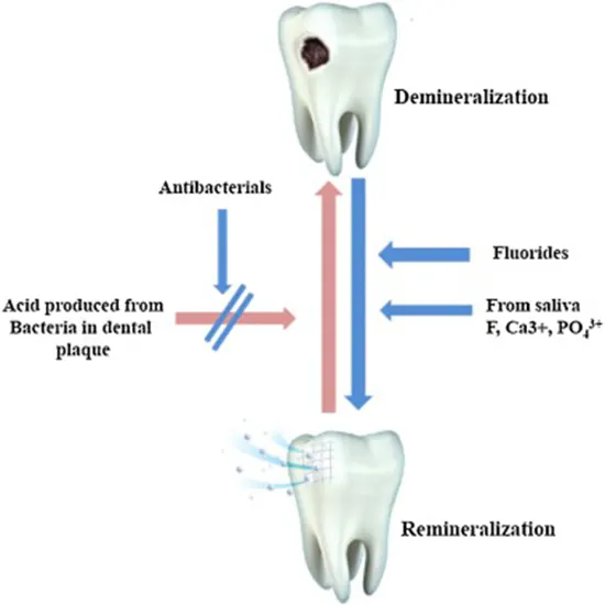 Dental Caries | Test Price in Delhi | Ganesh Diagnostic