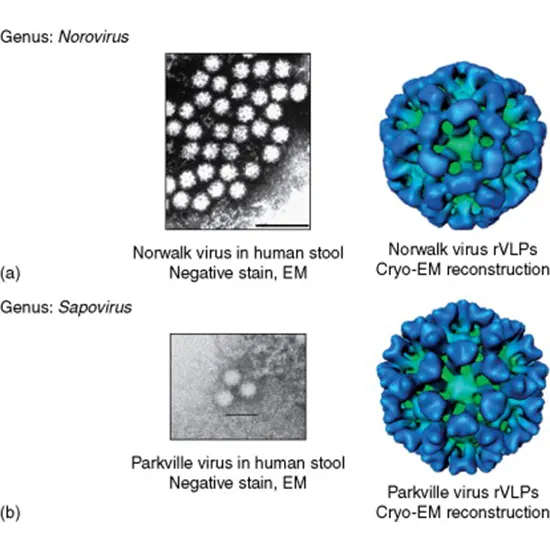 Calicivirus Infection | Test Price in Delhi | Ganesh Diagnostic