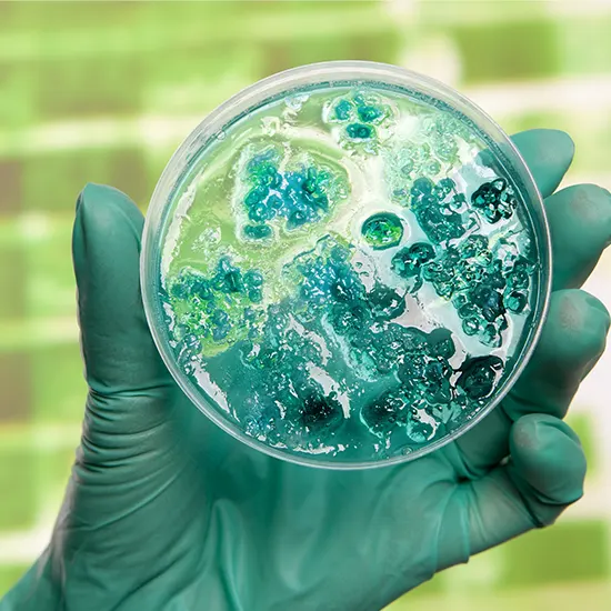 Infectious Agent | Test Price In Delhi | Cost Near Me, India | Ganesh ...