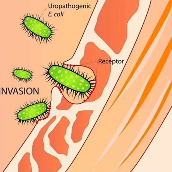 Hemolytic Uremic Syndrome HUS | Test Price in Delhi | Ganesh Diagnostic