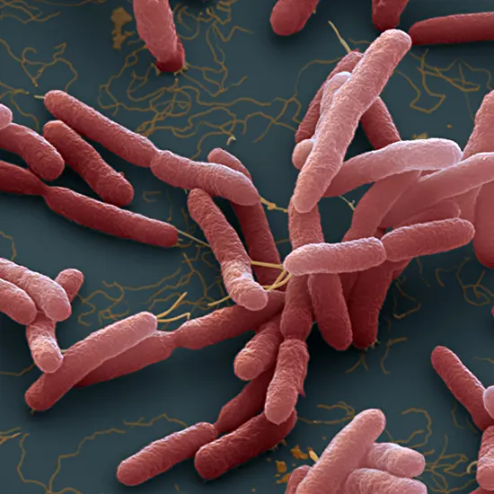 Melioidosis (Whitmore's Disease)