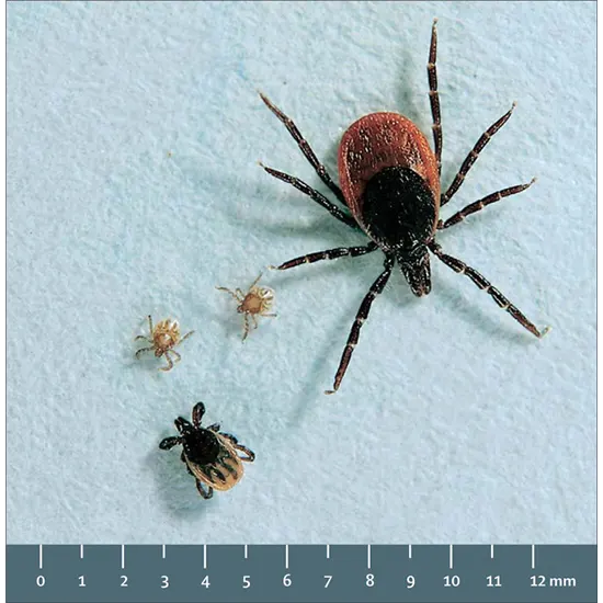 Tick-Borne Encephalitis Virus | Test Price in Delhi | Ganesh Diagnostic