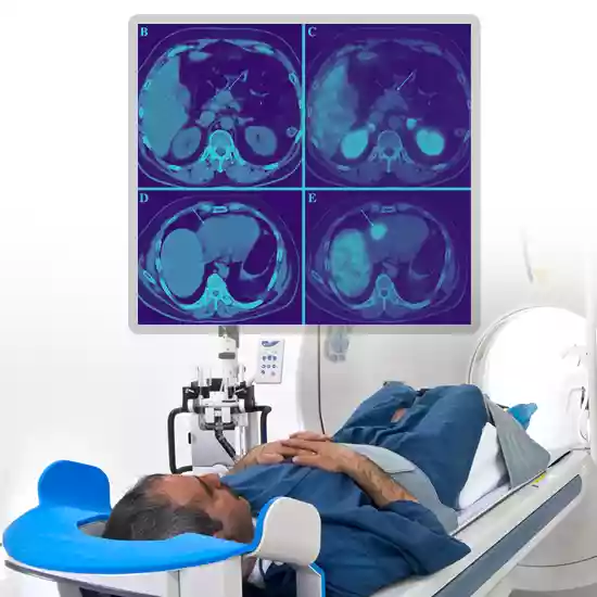 DOTA PET Scan | Test Price In Delhi | Cost Near Me, India | Ganesh ...