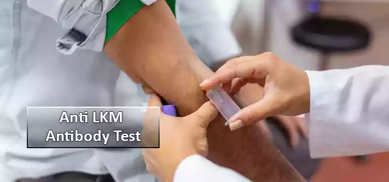 Anti-LKM (Liver Kidney Microsomal) Test - Book Test at Low Price