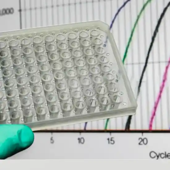 Real Time PCR for MTB Test In delhi, NCR | Ganesh Diagnostic