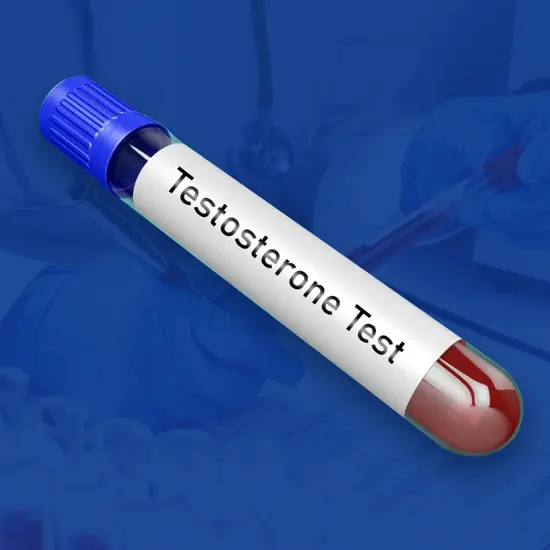 Types Of Hormone Tests | List Of Hormones Test Price, Delhi India ...