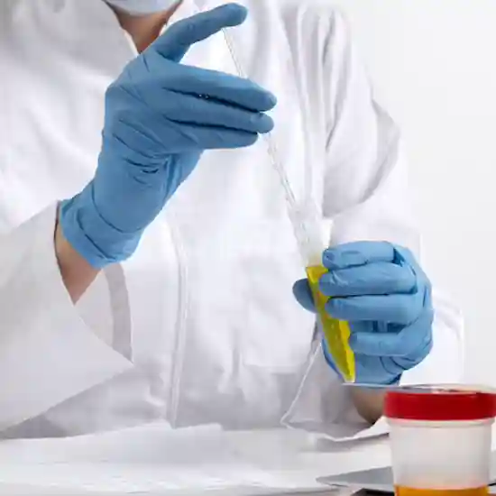 Acetone / Ketone Body Serum Test in Delhi NCR, India | GDIC