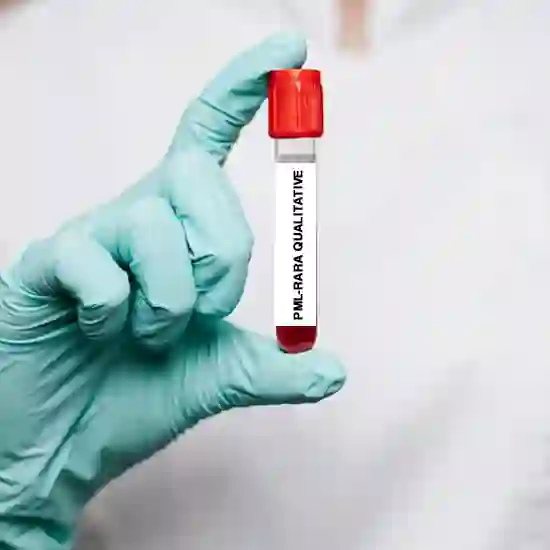PCR (Polymerase Chain Reaction) Tests | PCR Test In Delhi, India ...