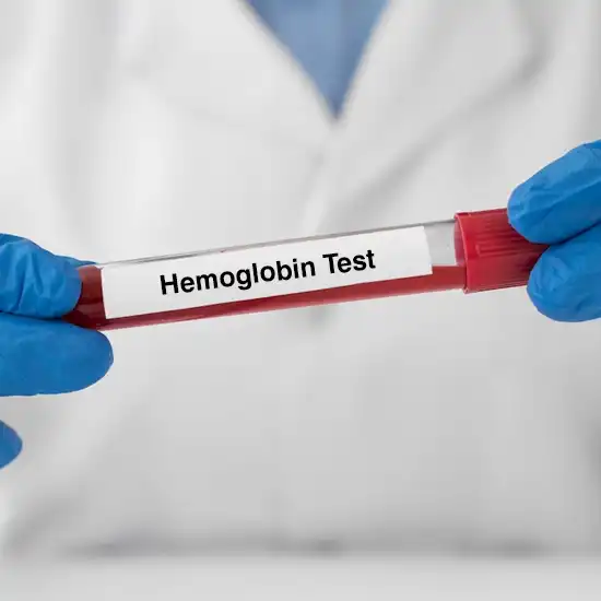 Book Hemoglobin Test at Home in Delhi, India | Ganesh Diagnostic