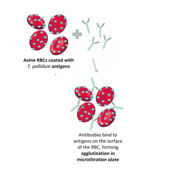 Book Treponema Pallidum Hemagglutination (TPHA) | Test Price In Delhi ...