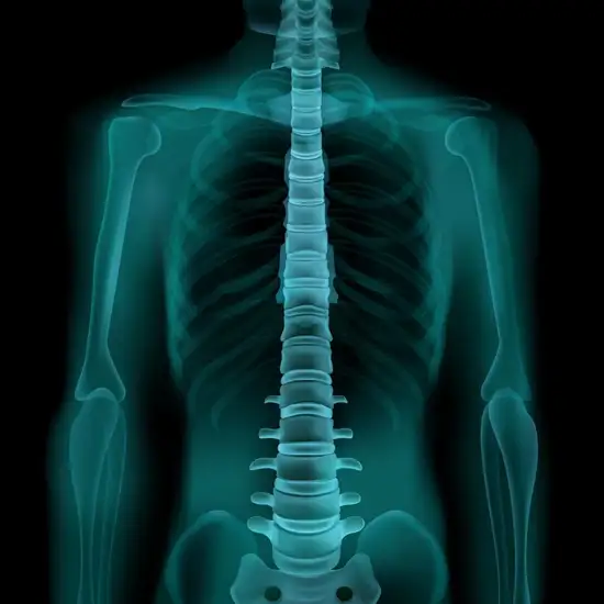 Whole Body Bone Scan - Book Test at Flate 20% OFF | Nuclear Medicine