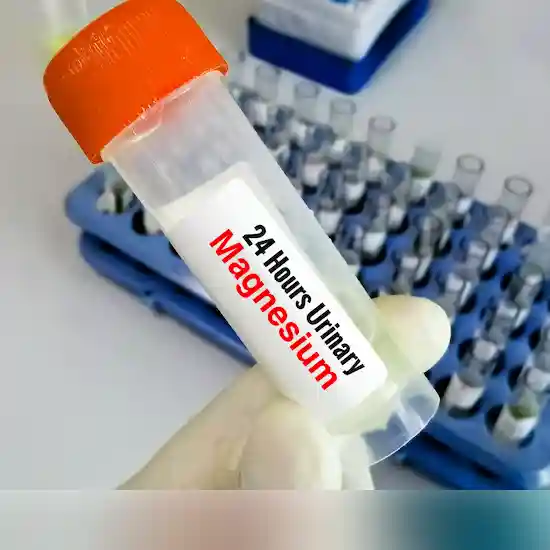 Gastroesophageal (GER) Scan Procedure