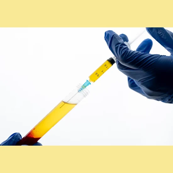 Calcium, 24 Hour Urine | Test Price In Delhi | Cost Near Me, India ...