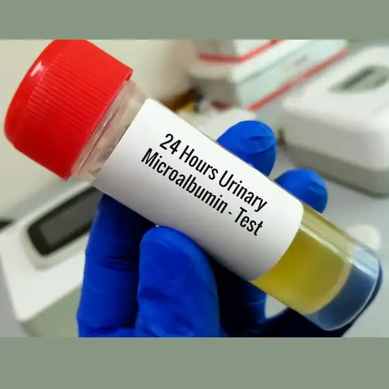 24 Hour Urine Microalbumin Test Near You in Delhi | Book Test at Low Price
