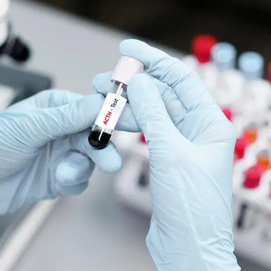 X-Ray Foot Lateral View (Right/Left) Procedure - Ganesh Diagnostic