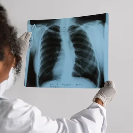 X-Ray Test at Home | Door Step Service in Delhi/NCR