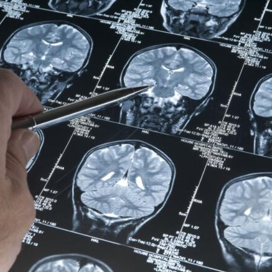 Retrograde urethrogram and micturating cystogram (RGU and MCU) Test ...
