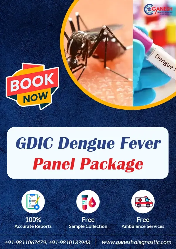 GDIC Dengue Fever Panel Package - Book Health Checkups | Ganesh Diagnostic