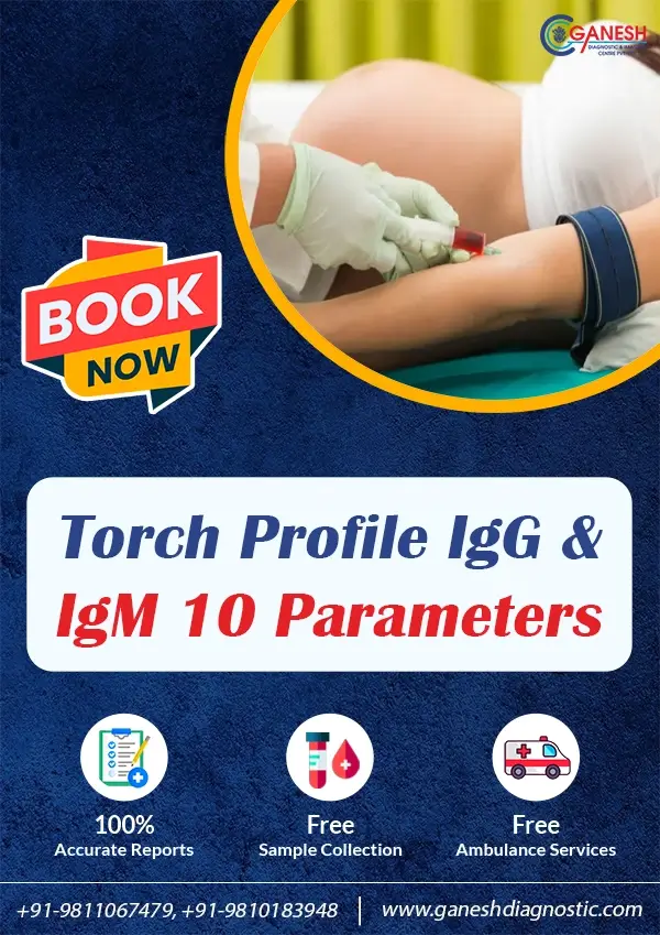 Torch Profile IgG and IgM 10 Parameters - Book Health Checkups | Ganesh ...