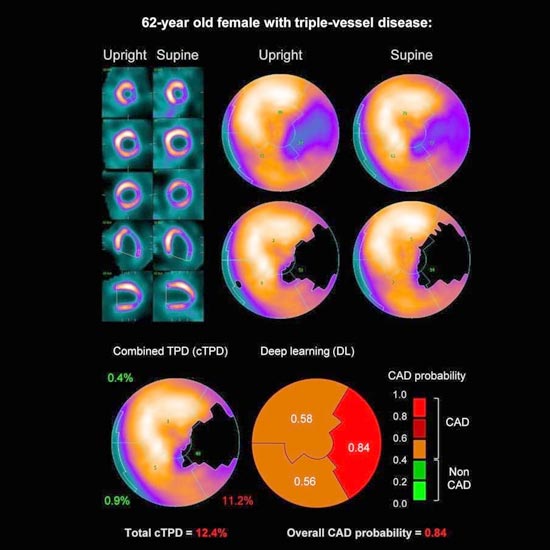 Retrograde urethrogram and micturating cystogram (RGU and MCU) Test ...