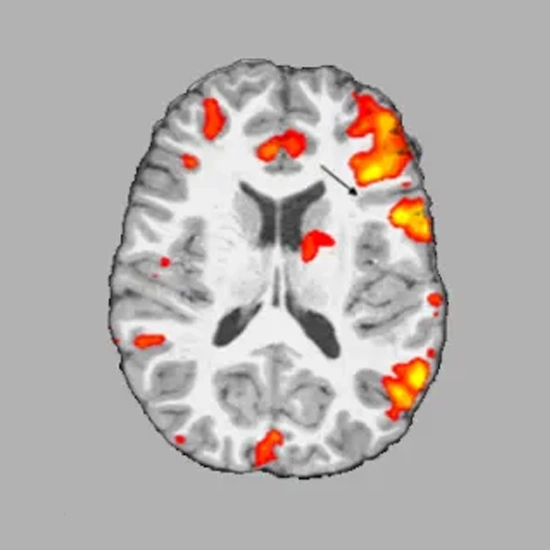 X-RAY ABDOMEN ERECT AND SUPINE VIEW PROCEDURE